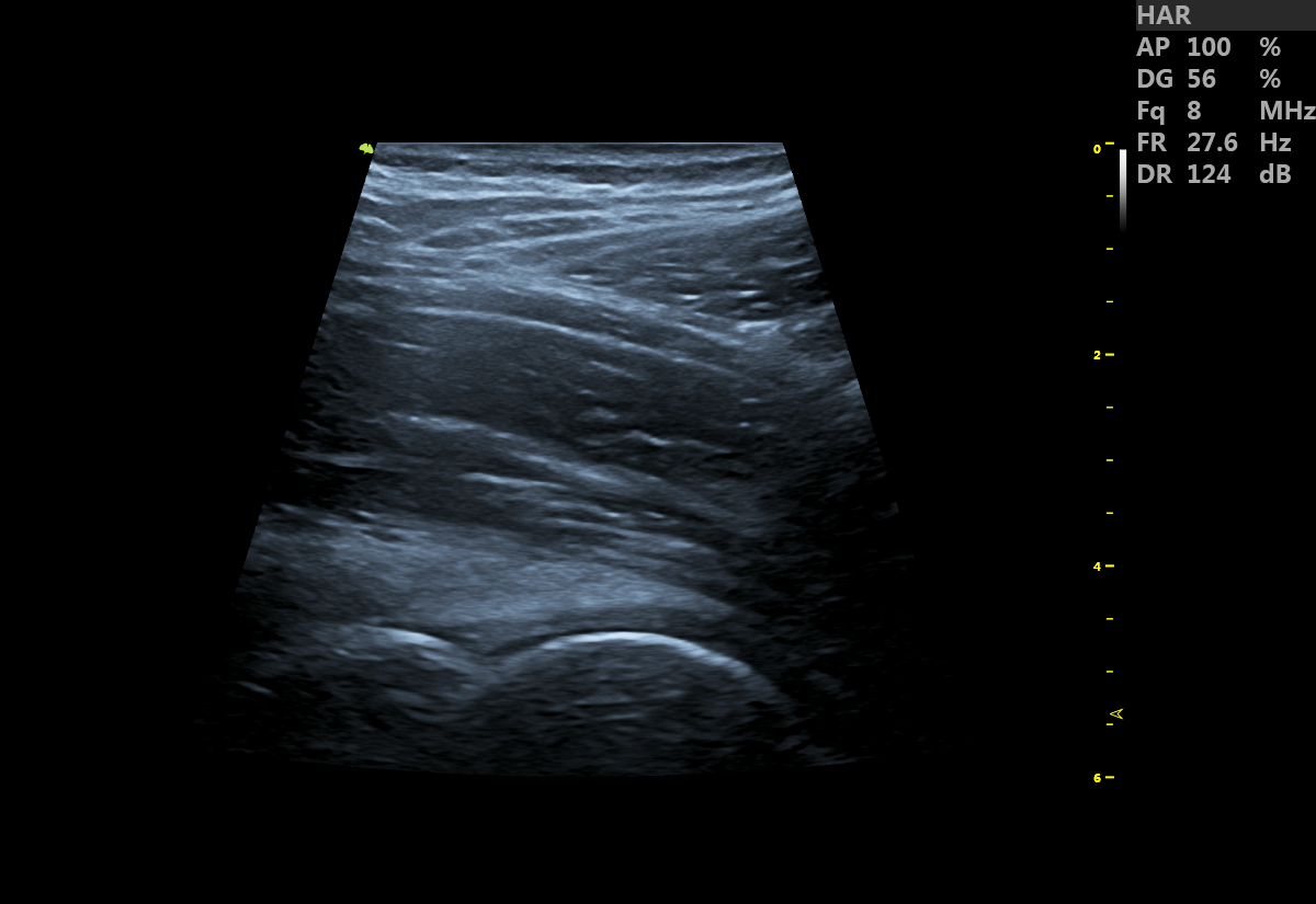 Vinno France - VINNO E-MSK : échographe couleur performant et compact